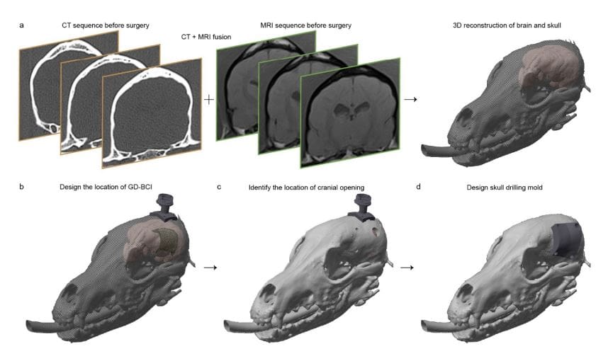 Guidewire-Driven ECoG Arrays Deploy 256 Electrodes Across 4 Cm² For ...